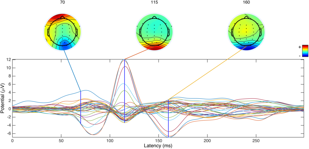 EEG | Deborah Apthorp