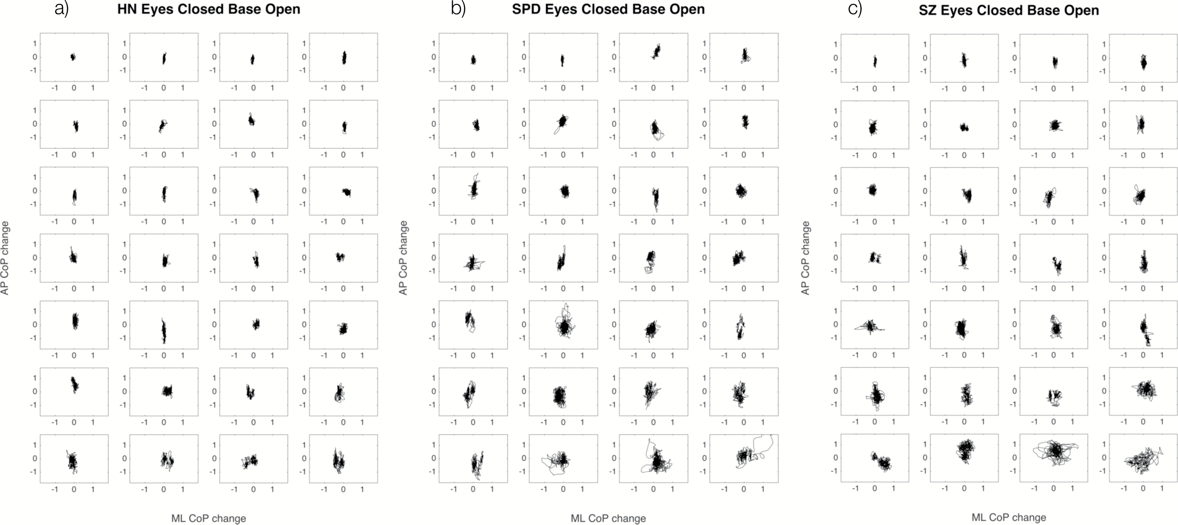 Postural sway abnormalities in schizotypal personality disorder ...