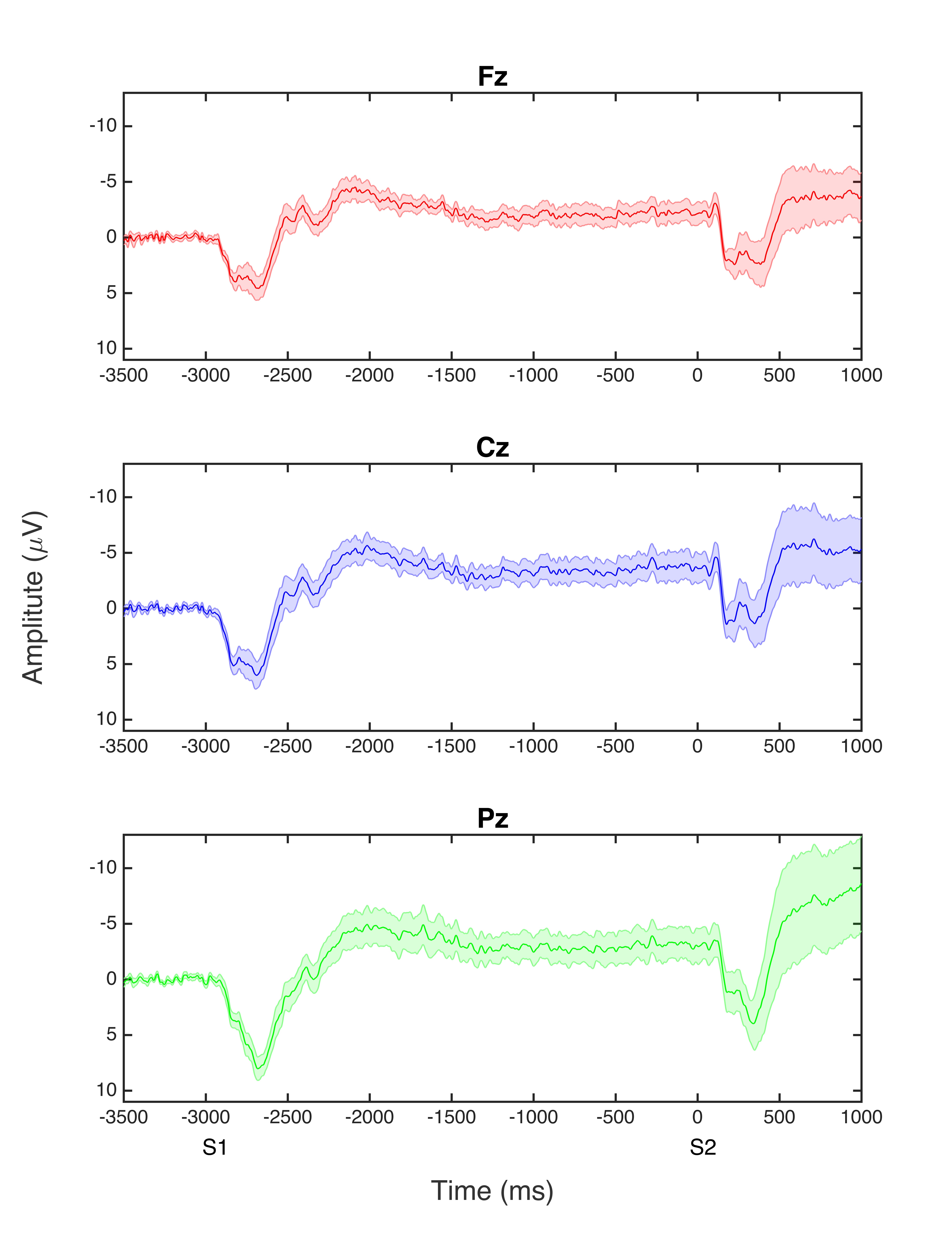 Abnormal electrophysiological motor responses in Huntington’s disease ...